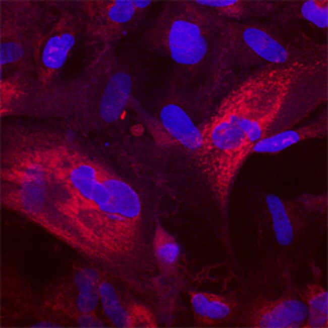 Human Phospho-Akt1 (T308) Antibody, R 100ug; Unlabeled:Antibodies, Monoclonal | Fisher Scientific