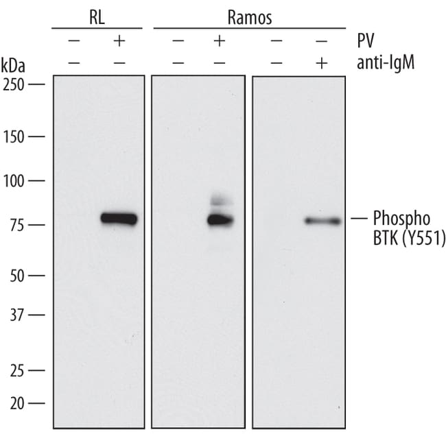 Human Phospho-BTK (Y551) Antibody, R&D Systems™ 25μg; Unlabeled ...