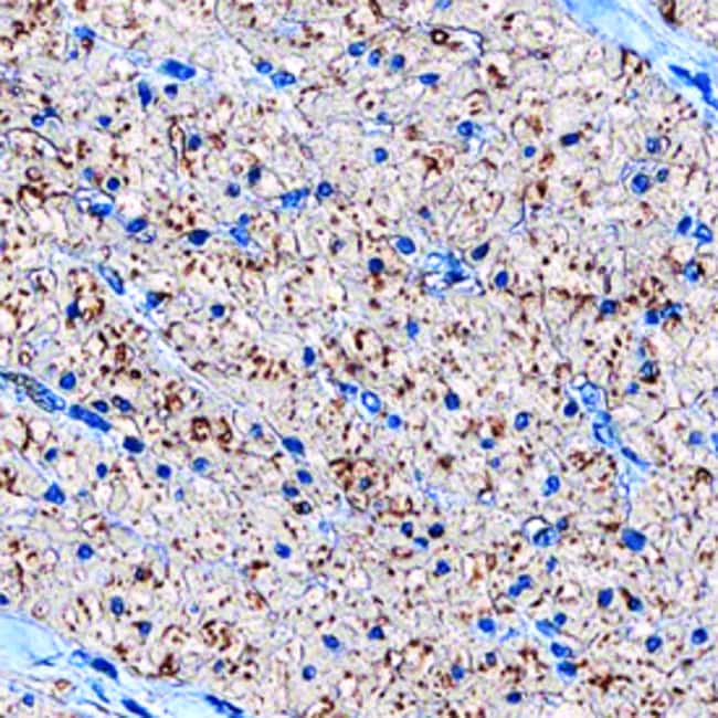 Calponin 1 Sheep anti-Human, Polyclonal, R D Systems 25μg; Unlabeled ...