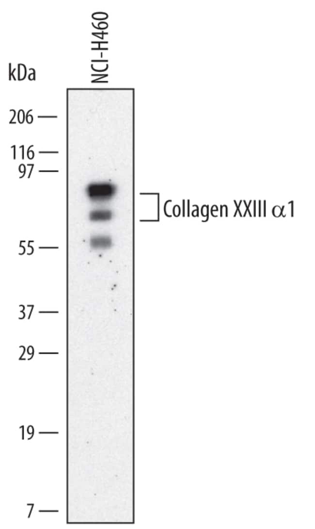 Human Collagen XXIII alpha 1 Antibody, R D Systems 100ug; Unlabeled ...