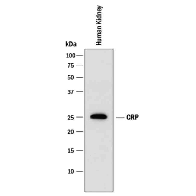Human/Mouse/Porcine C-Reactive Protein/CRP Antibody, R D Systems 500ug ...
