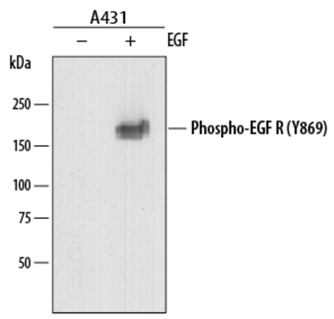 Human Phospho-EGFR (Y869) Antibody, R D Systems 100ug; Unlabeled:Anticuerpos | Fisher Scientific