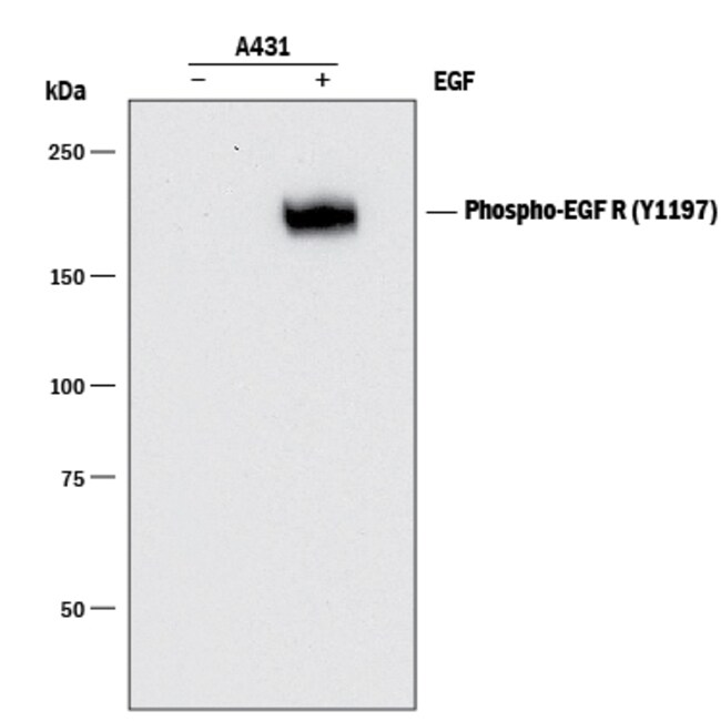 Human Phospho-EGFR (Y1197) Antibody 100ug; Unlabeled:Antibodies, Monoclonal | Fisher Scientific
