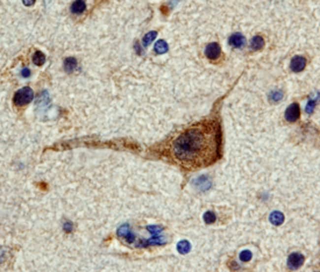 Human/Mouse/Rat FAK Antibody, R D Systems 100μg; Unlabeled:Antibodies ...