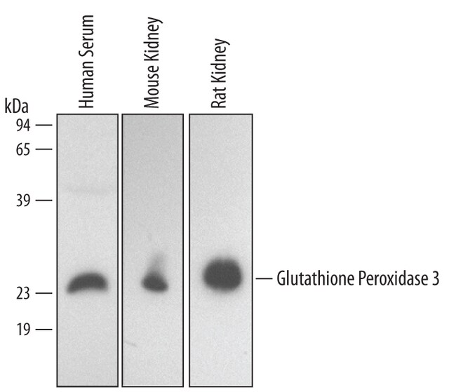 Glutathione Peroxidase 3/GPX3 Goat anti-Human, Mouse, Rat, Polyclonal ...
