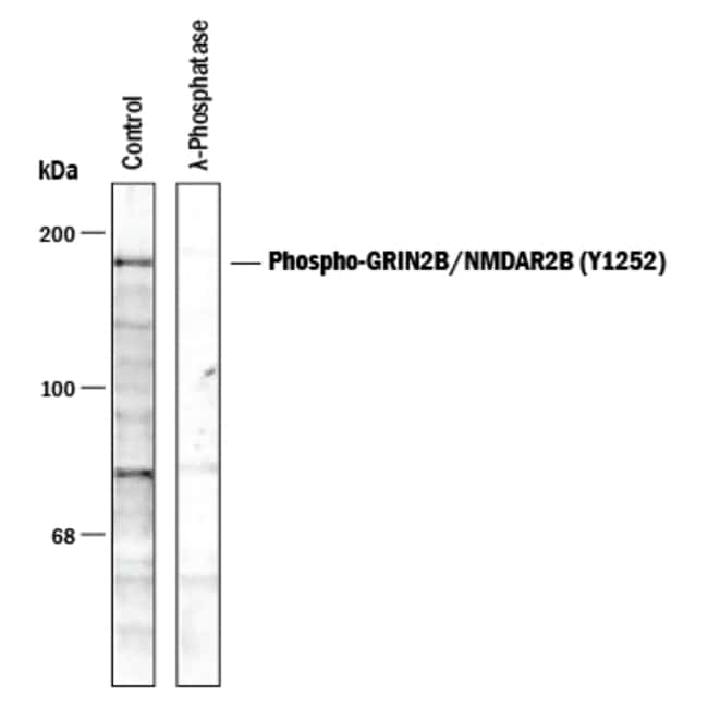 Human/Rat/Primate Phospho-GRIN2B/NMDAR2B (Y1252) Antibody, R&D Systems ...