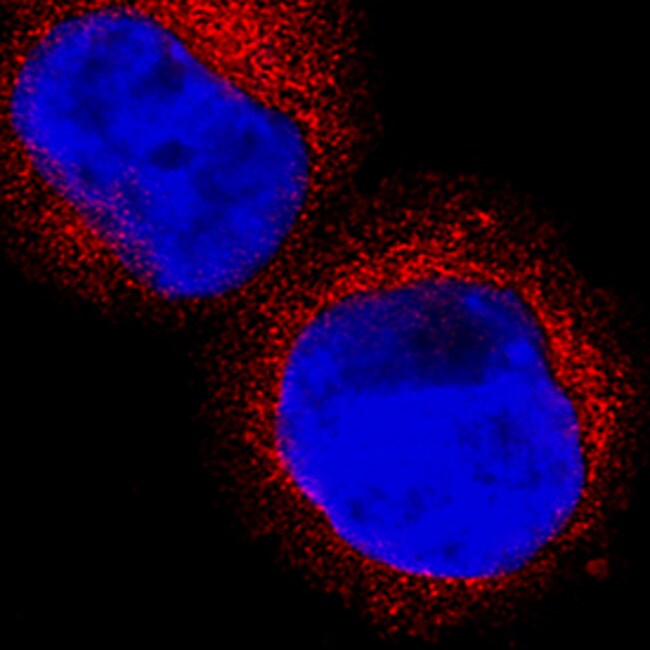 Human Hematopoietic Prostaglandin D Synthase/HPGDS Antibody, R 25μg ...