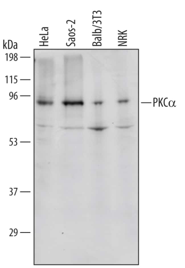 Human/Mouse/Rat PKC alpha Antibody, R D Systems 100μg; Unlabeled ...