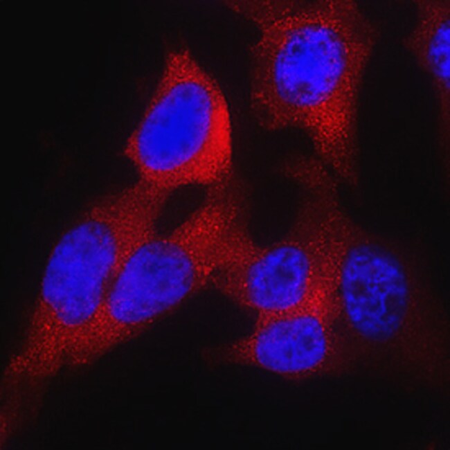 PKM2 Mouse anti-Human, Mouse, Rat, Clone: 945126, R D Systems 25μg ...