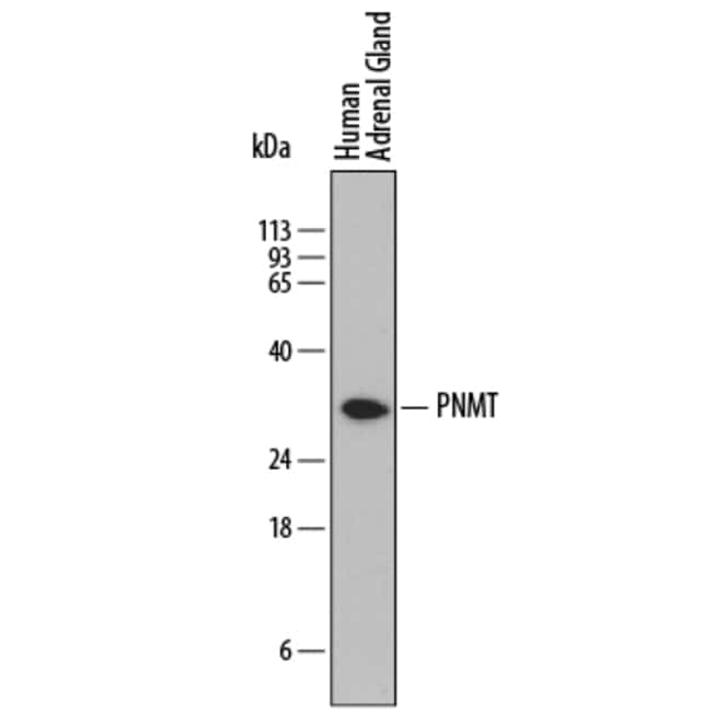 Human PNMT Antibody, R D Systems 100μg; Unlabeled:Antibodies ...