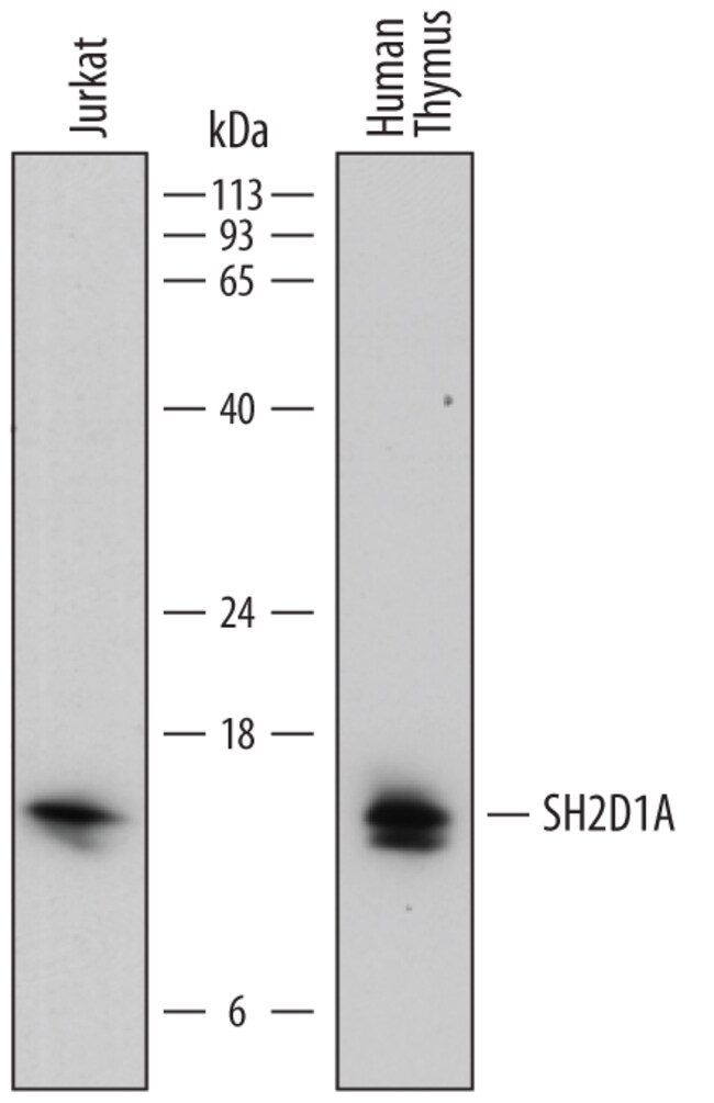 Human SH2D1A Antibody 100ug; Unlabeled:Antibodies, Monoclonal | Fisher ...
