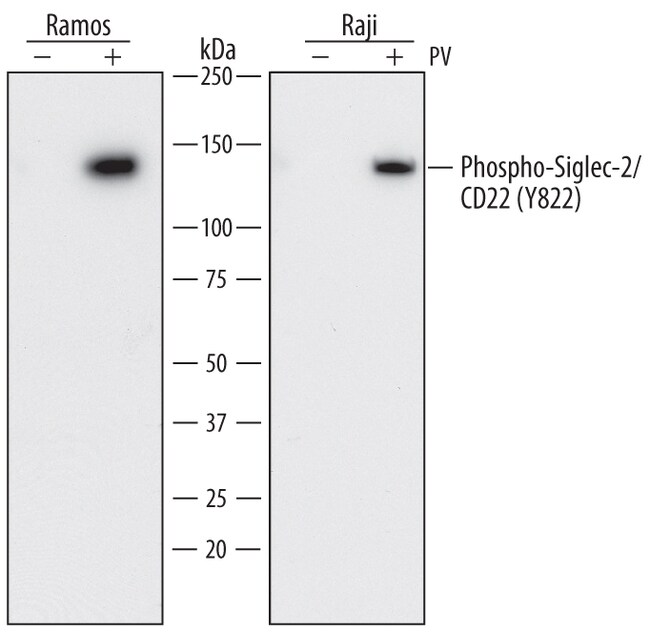 Human Phospho-Siglec-2/CD22 (Y822) Antibody, R&D Systems™ 100ug; Unlabeled | Fisher Scientific