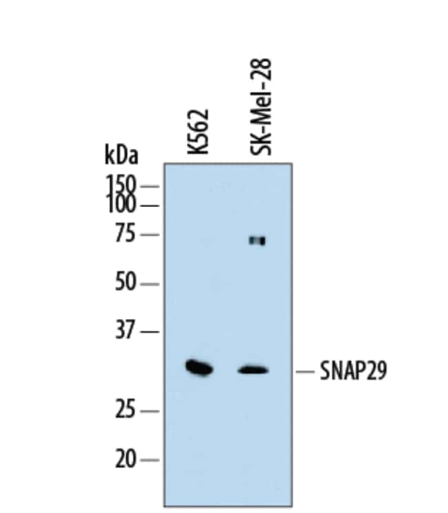 SNAP29 Sheep anti-Human, Polyclonal, R D Systems 100μg; Unlabeled ...