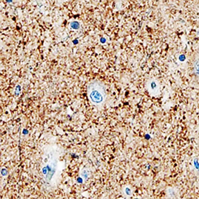 Human/Mouse/Rat alpha-Synuclein Antibody, R D Systems 25μg; Unlabeled ...