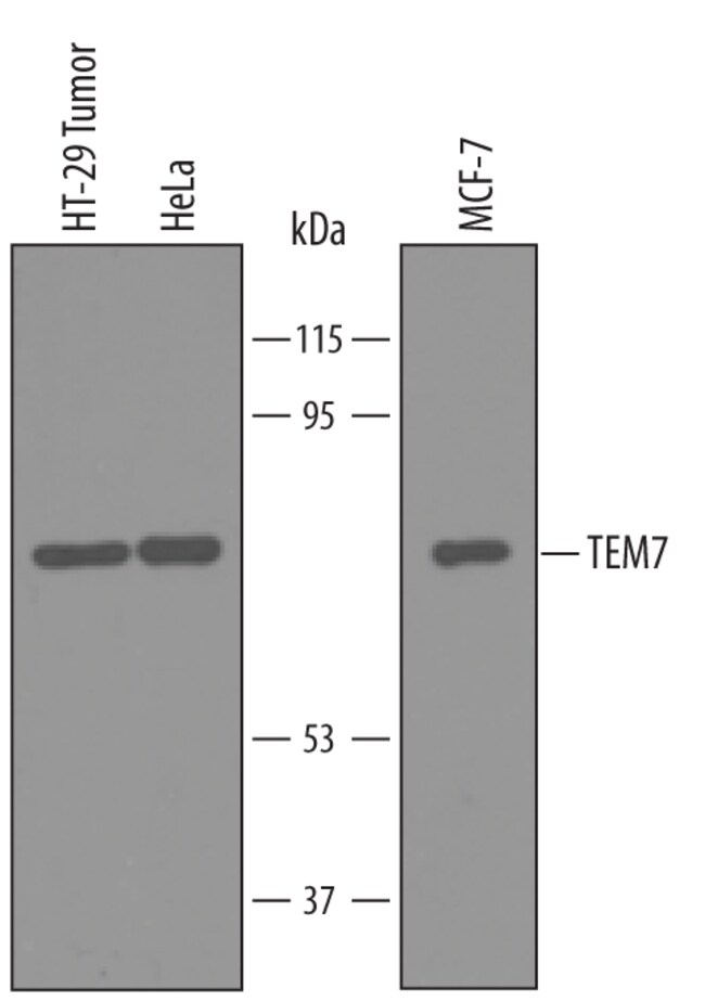 Human TEM7/PLXDC1 Isoform 1 Antibody, R D Systems 100μg; Unlabeled ...