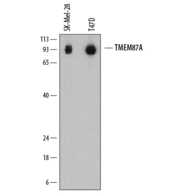 Human TMEM87A Antibody 100ug; Unlabeled:Antibodies, Monoclonal | Fisher ...