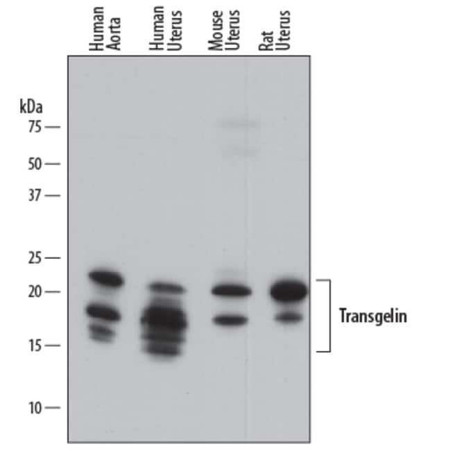 Human/Mouse/Rat Transgelin/TAGLN Antibody 100ug; Unlabeled:Antibodies ...