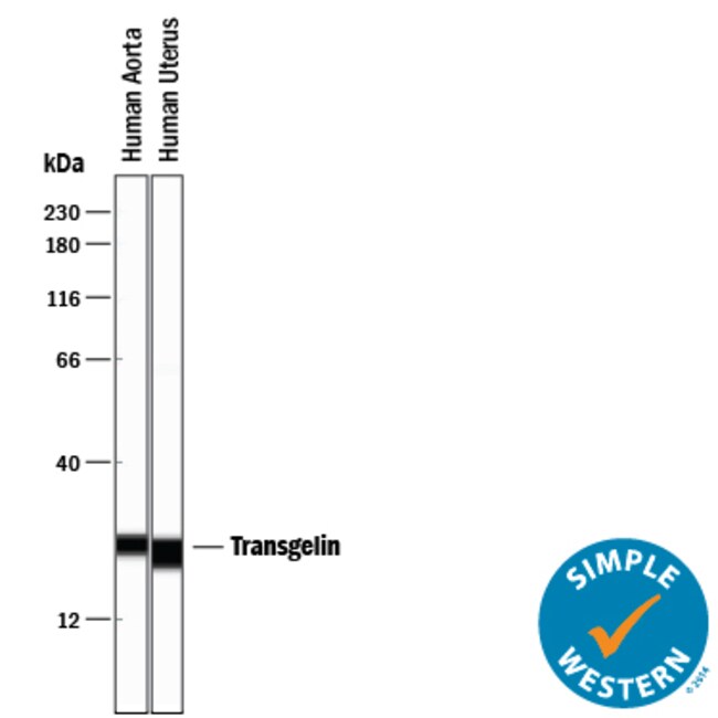 Human Transgelin/TAGLN Antibody, R&D Systems™ 100ug; Unlabeled | Fisher ...