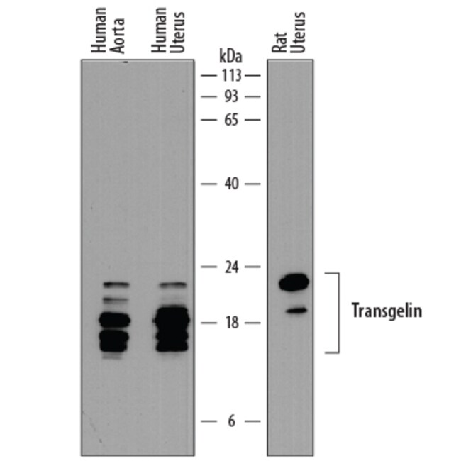 Human Transgelin/TAGLN Antibody, R D Systems 100ug; Unlabeled ...