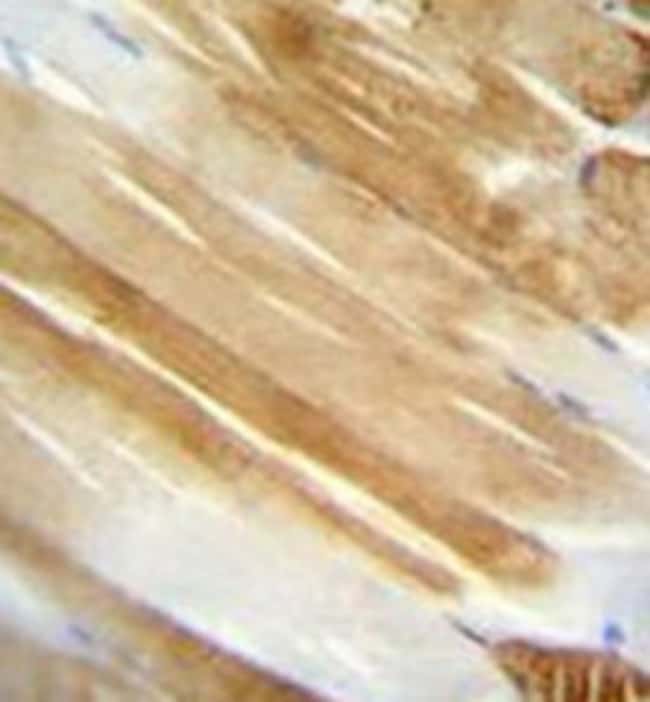 NCL Mouse anti-Human, Clone: 130CT43.8.5, Abnova 400μL; Unlabeled ...