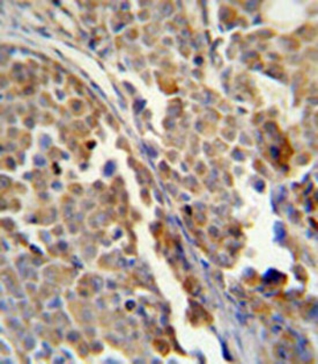 ALDH3A2 Mouse anti-Human, Clone: 151CT1.3.1, Abnova 400µL; Unlabeled ...