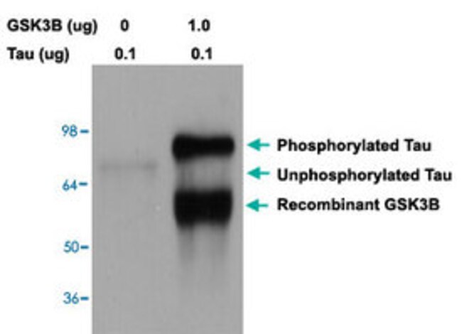 Abnova Human GSK3B (P49841) Full-length Recombinant Protein with His ...