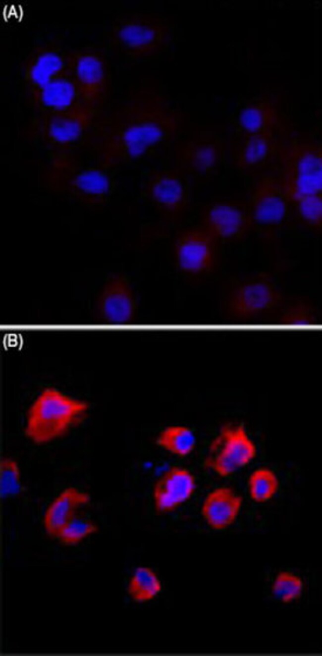 Phosphothreonine Rabbit, Clone: RM102, Abnova™ 100μg; Unlabeled ...
