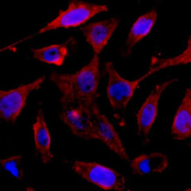 Beta Actin Rabbit, Clone: RM112, Abnova™ 100μL; Unlabeled | Fisher ...