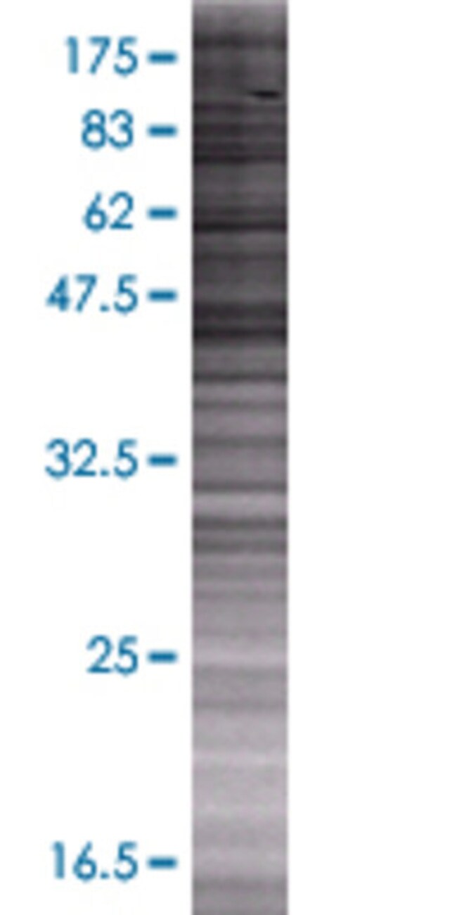 Abnova CASQ2 293T Cell Transient Overexpression Lysate (Denatured ...