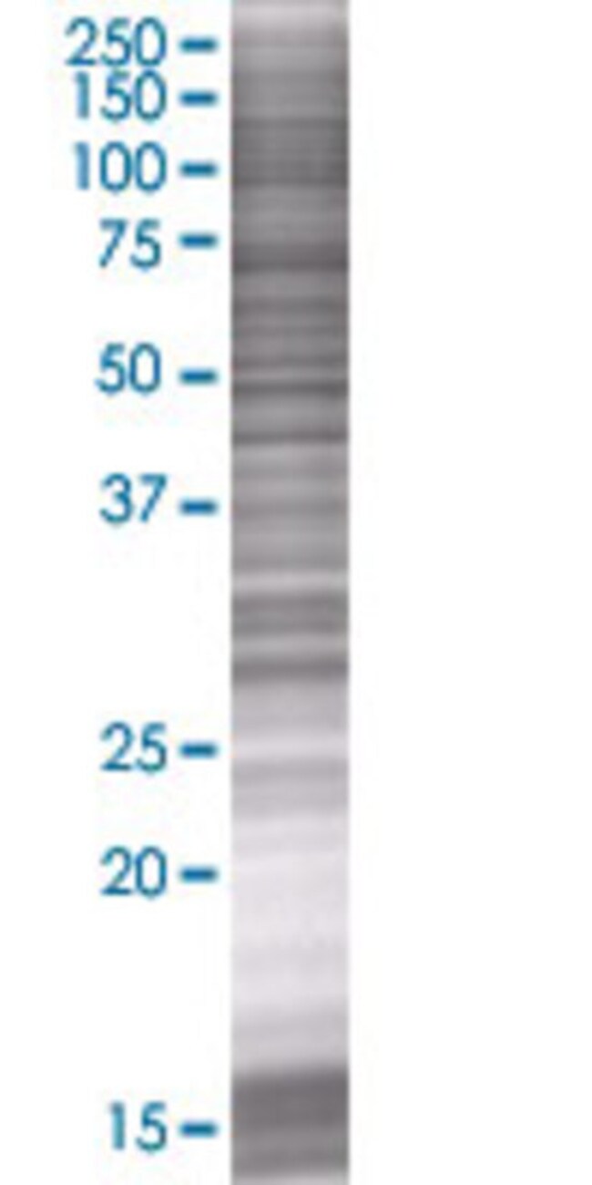 Abnova DCK 293T Cell Transient Overexpression Lysate (Denatured) (T02 ...