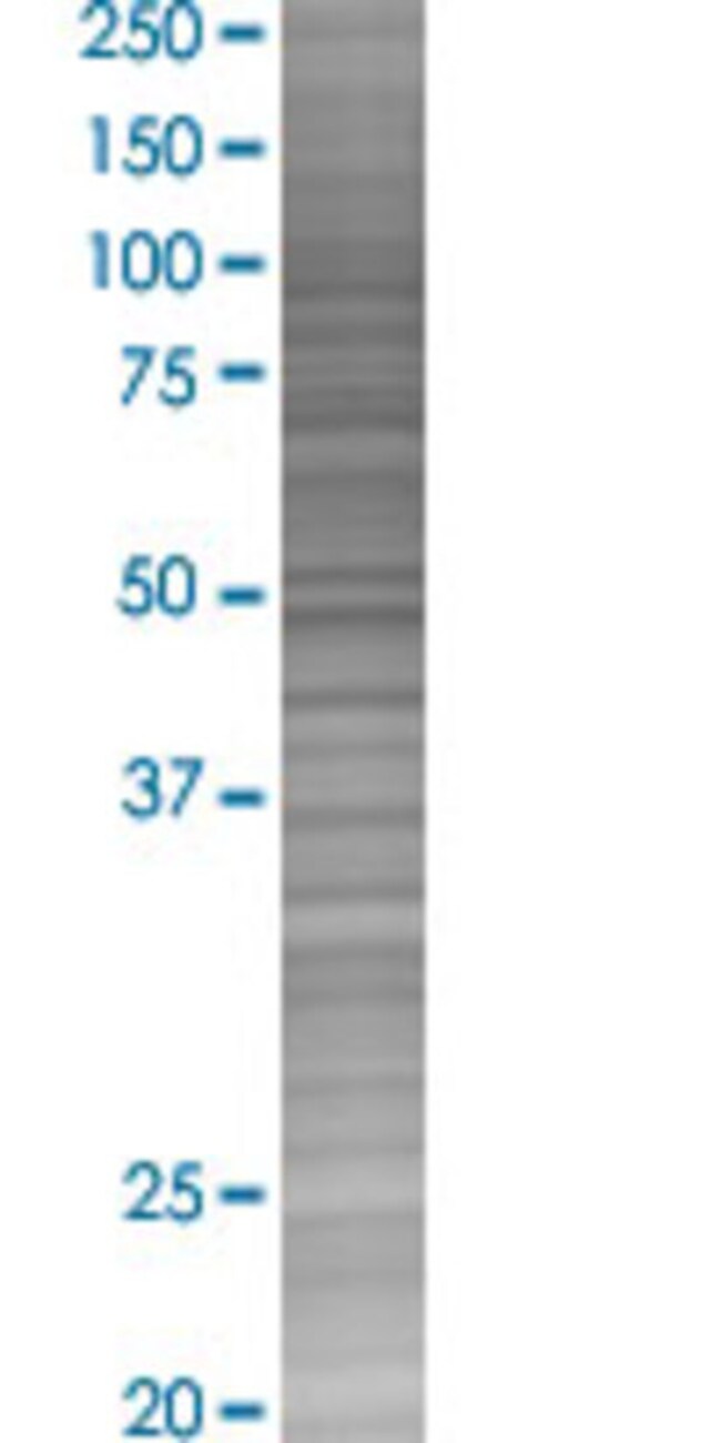 Abnova RFX2 293T Cell Transient Overexpression Lysate (Denatured) 100μL ...