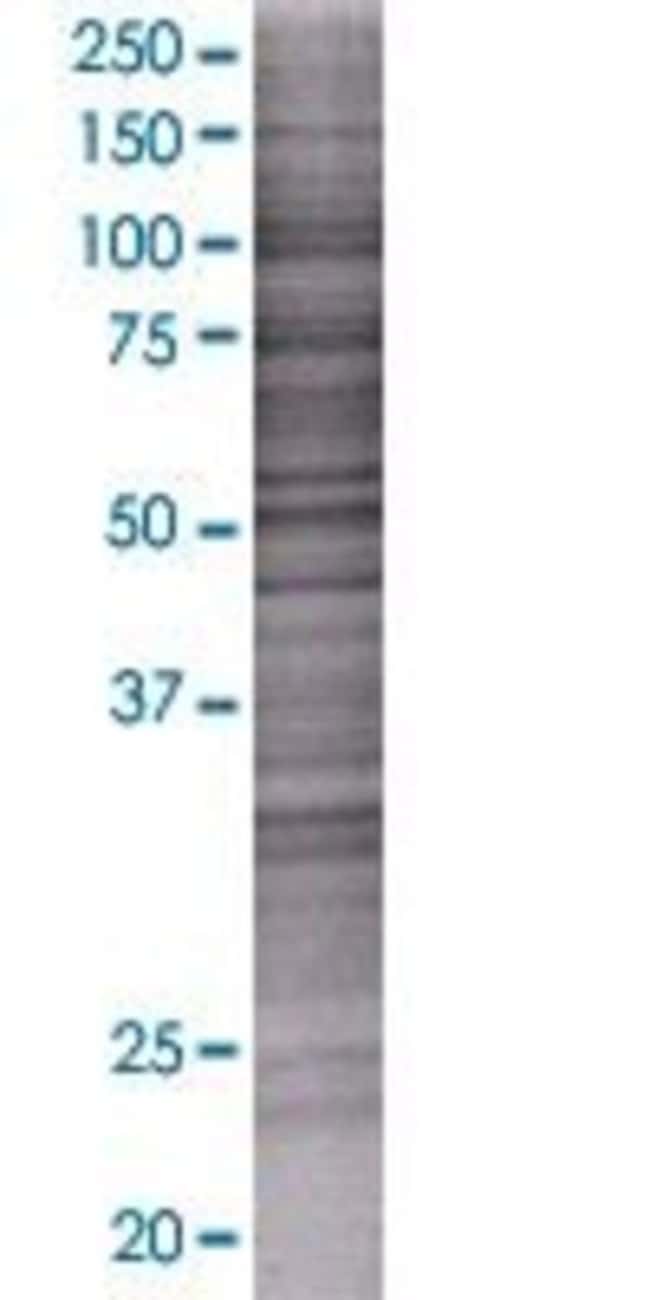 Abnova RBM12B 293T Cell Transient Overexpression Lysate (Denatured ...