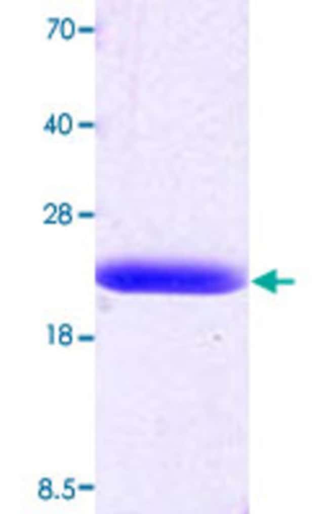 Abnova™ Human PPIB (NP_000933, 26 a.a. - 216 a.a.) Partial Recombinant ...