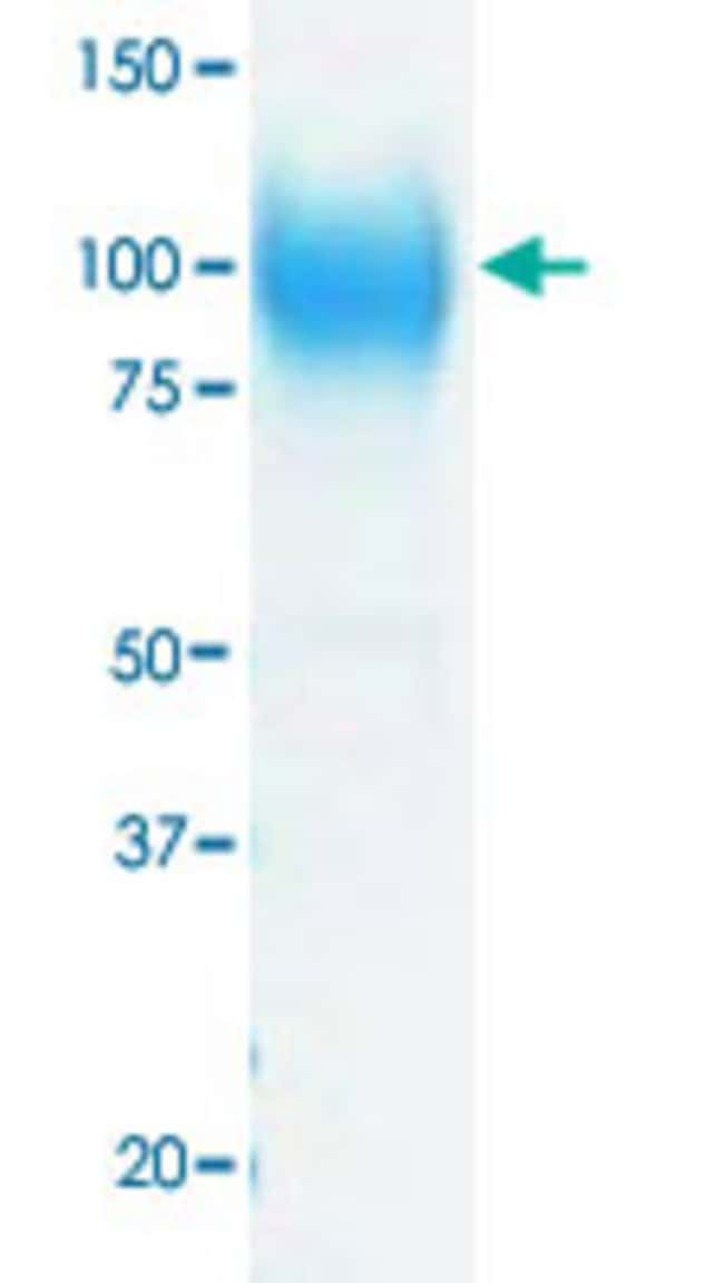 Abnova gp120 (HIV-1/Clade B) (M68893, 30 a.a. - 500 a.a.) Partial ...