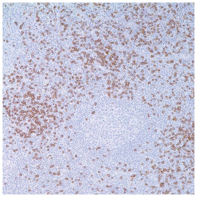 CD8 Monoclonal Antibody (FK18), Invitrogen 1 mL; Unconjugated ...