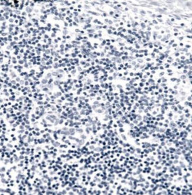 Endosialin Mouse anti-Human, Unlabeled, Clone: B1/35, BD 0.1mg ...