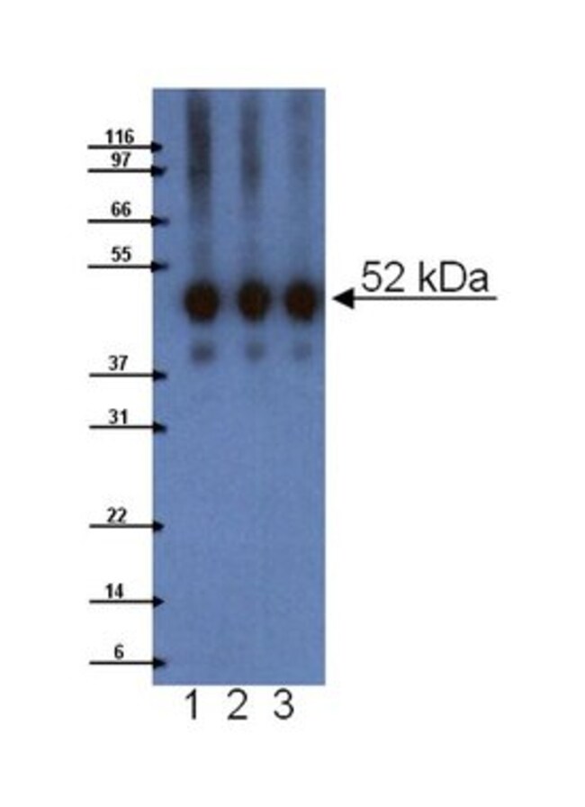 LSP-1 Mouse anti-Human, Unlabeled, Clone: 16, BD 50μg; Unlabeled ...