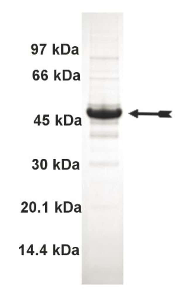 Eurofins DiscoverX PRKX Protein, Active Quantity: 250 μg Eurofins ...