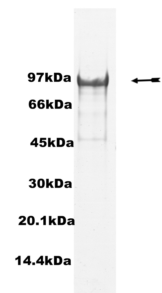 Eurofins DiscoverX Rsk4 Protein, Active Quantity: 250 μg | Fisher ...