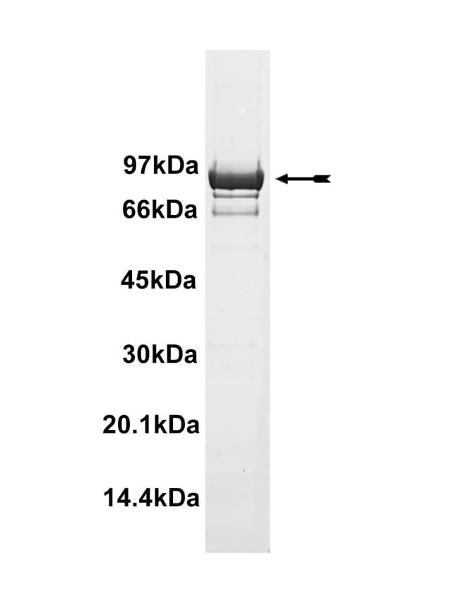 Eurofins DiscoverX EGFR (T790M) Protein, Active Quantity: 250 μg ...