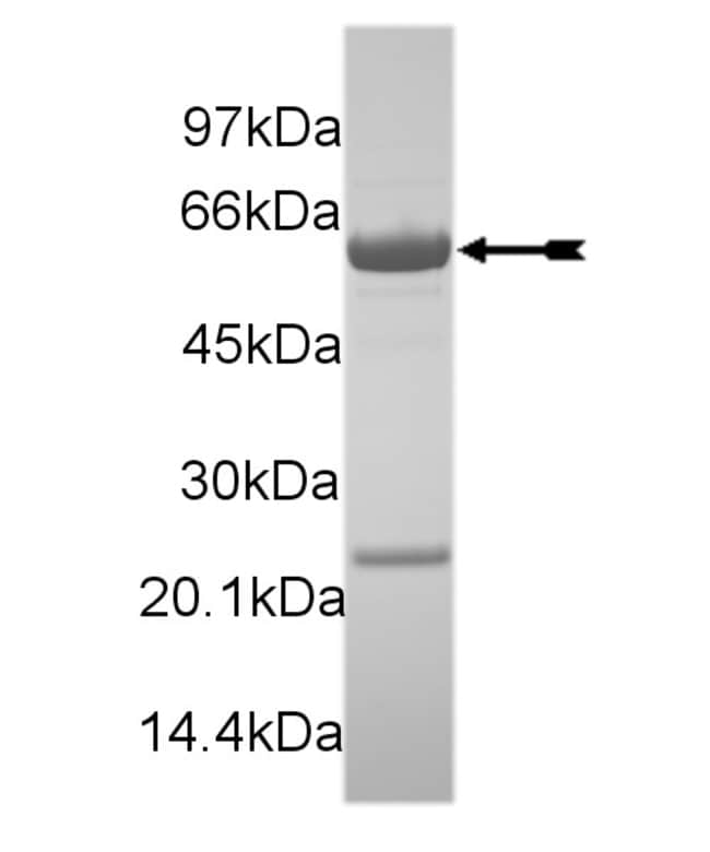 Eurofins DiscoverX Mer Protein, Active Quantity: 250 μg Eurofins ...