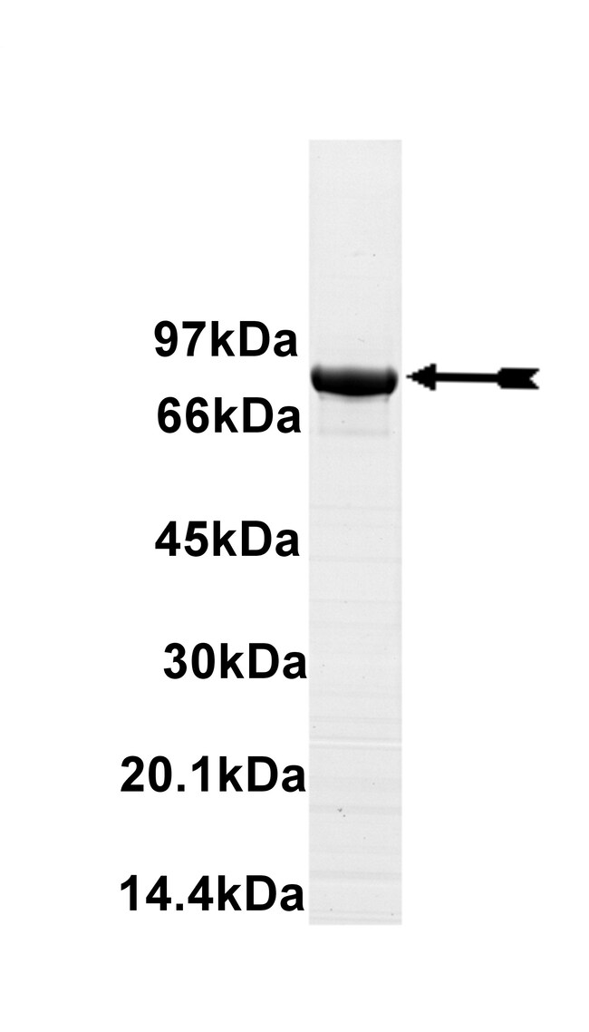 Eurofins DiscoverX GCK Protein, Active Quantity: 10 μg:Recombinant ...