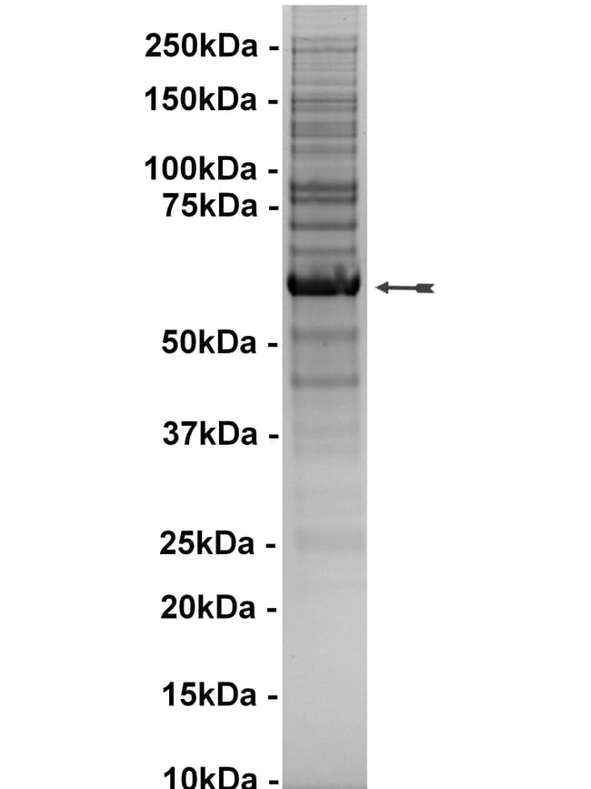 Eurofins DiscoverX Src (T341M) Protein, Active Quantity: 10 μg | Fisher ...