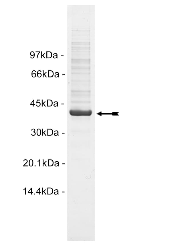 Eurofins DiscoverX TAO1 Protein, Active Quantity: 10 μg Eurofins ...