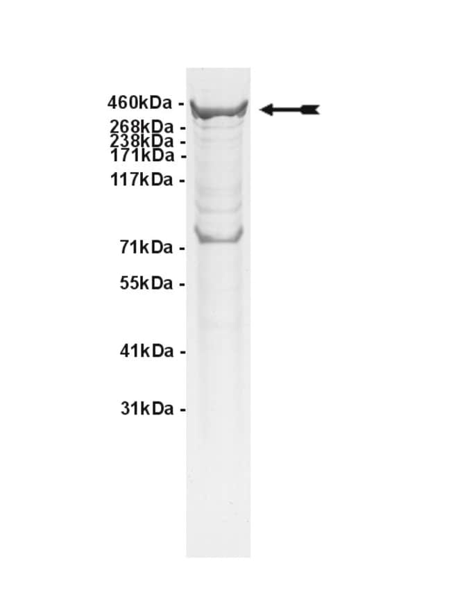 Eurofins DiscoverX ATM Protein, Active Quantity: 10 μg Eurofins ...