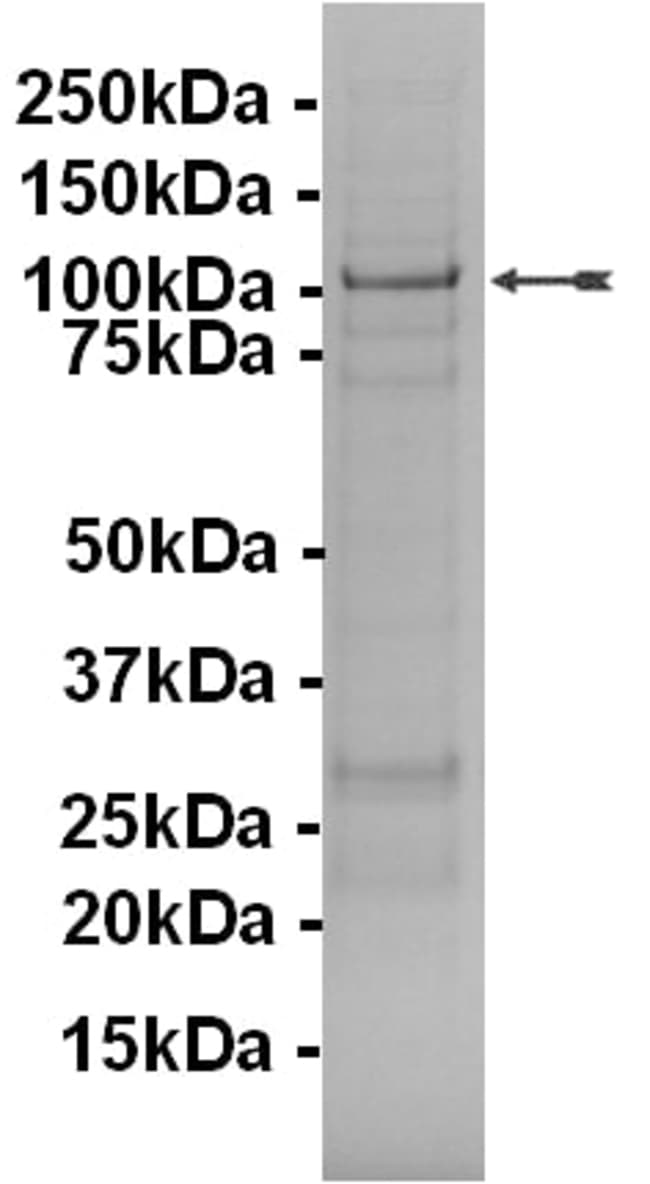 Eurofins DiscoverX NUAK2 Protein, Active 10 μg | Buy Online | Eurofins ...