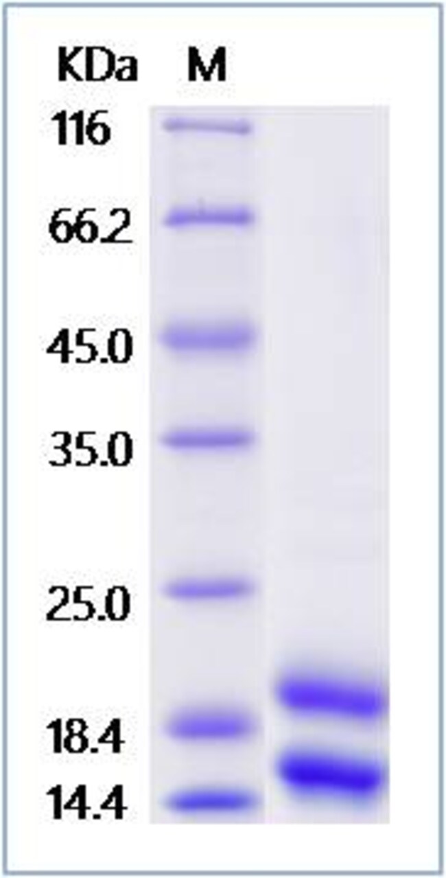 Sino Biological VEGF121 Protein, Human, Recombinant, HPLC-verified 1mg ...