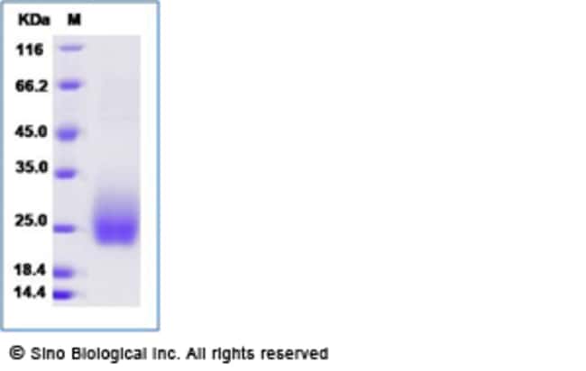 Sino Biological GM-CSF Protein, Human, Recombinant, HPLC-verified 100µg ...