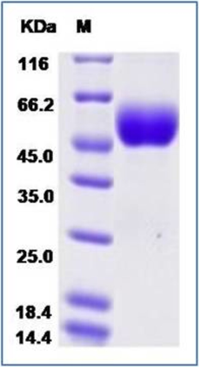 Sino Biological IL1R2 Protein, Human, Recombinant (His Tag), HPLC ...