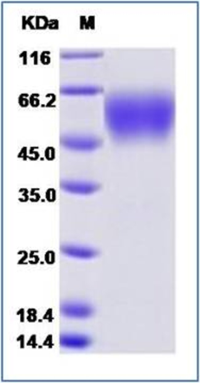 Sino Biological MICA Protein, Human, Recombinant (His Tag), HPLC ...